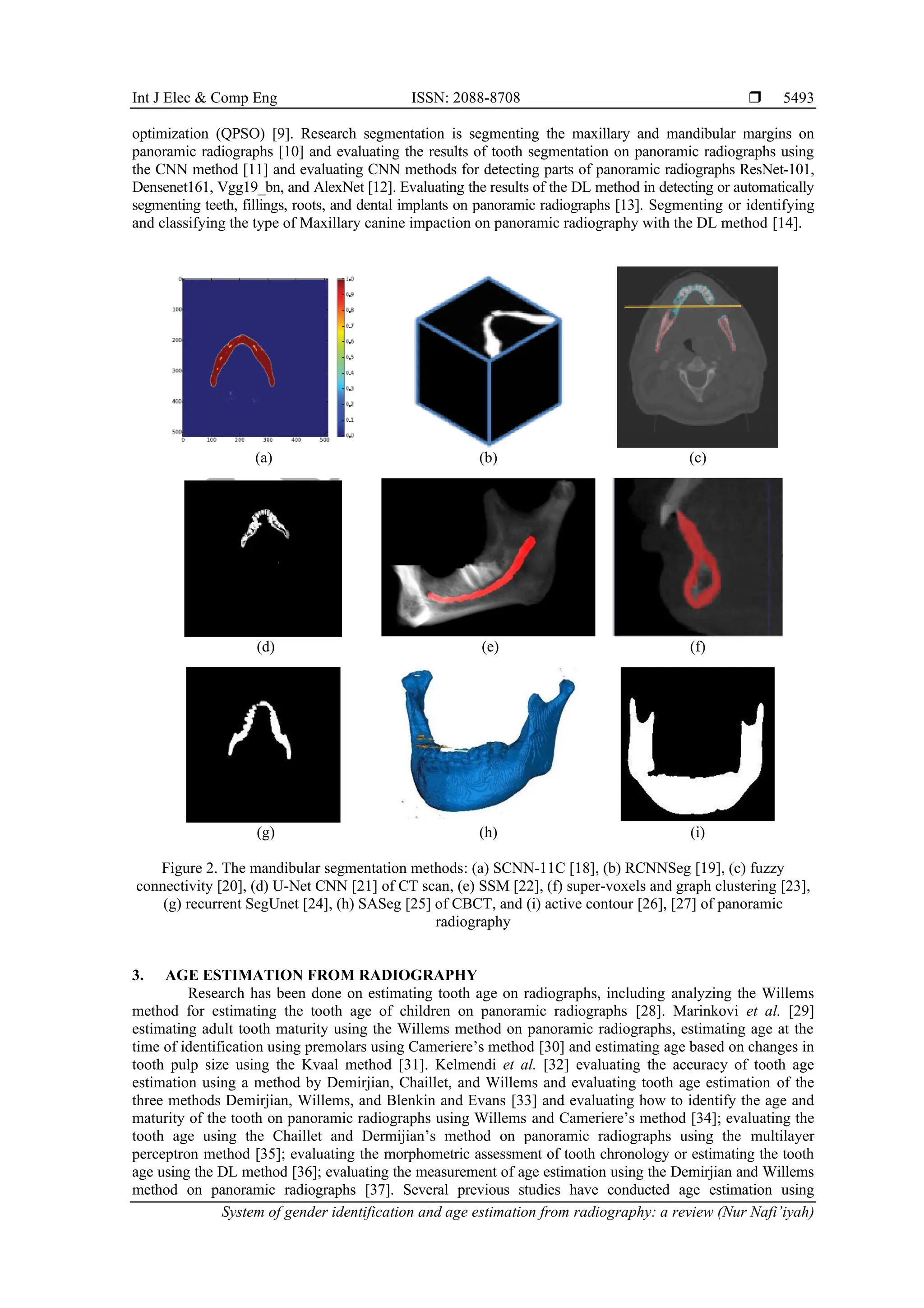 System of gender identification and age estimation from radiography: a ...