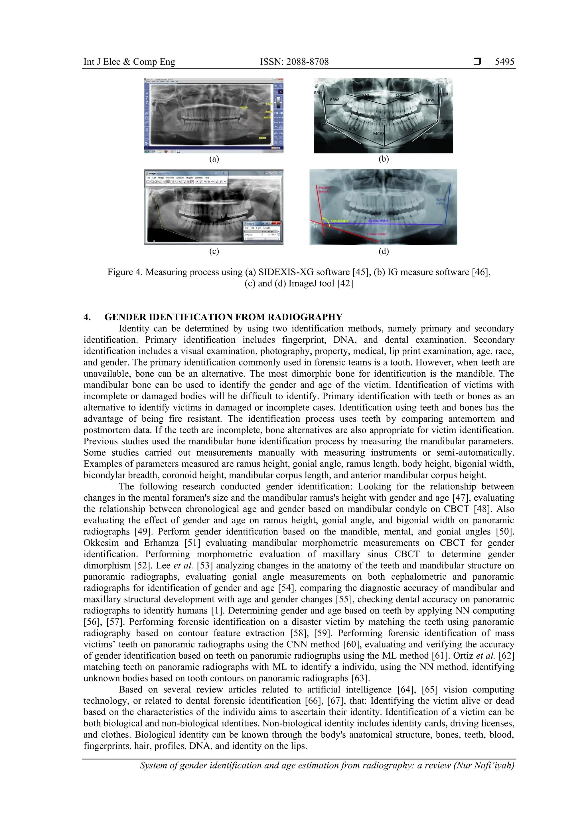 System of gender identification and age estimation from radiography: a ...
