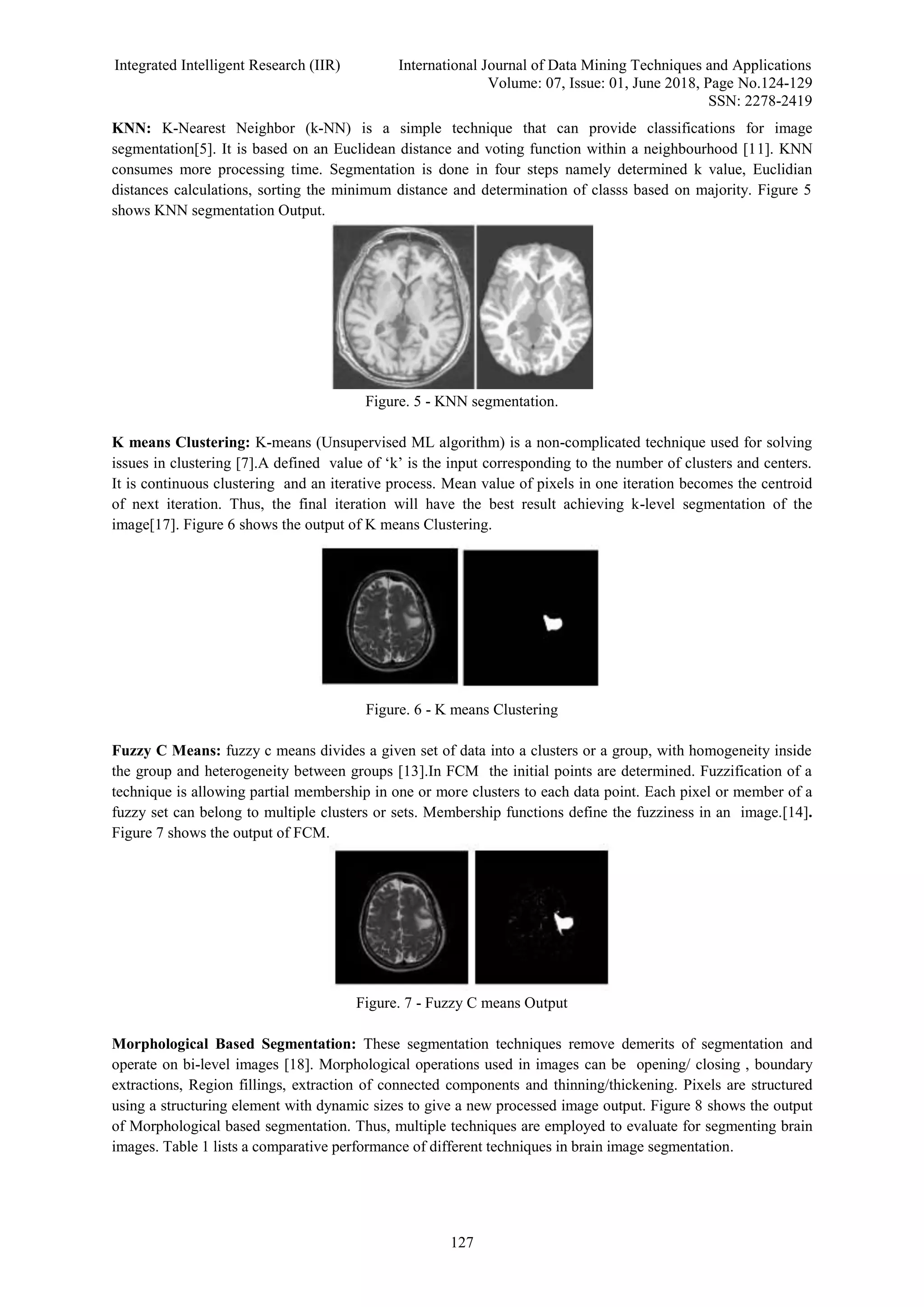 An Investigation Into Brain Tumor Segmentation Techniques Pdf