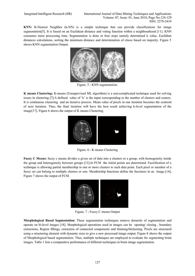 An Investigation into Brain Tumor Segmentation Techniques | PDF
