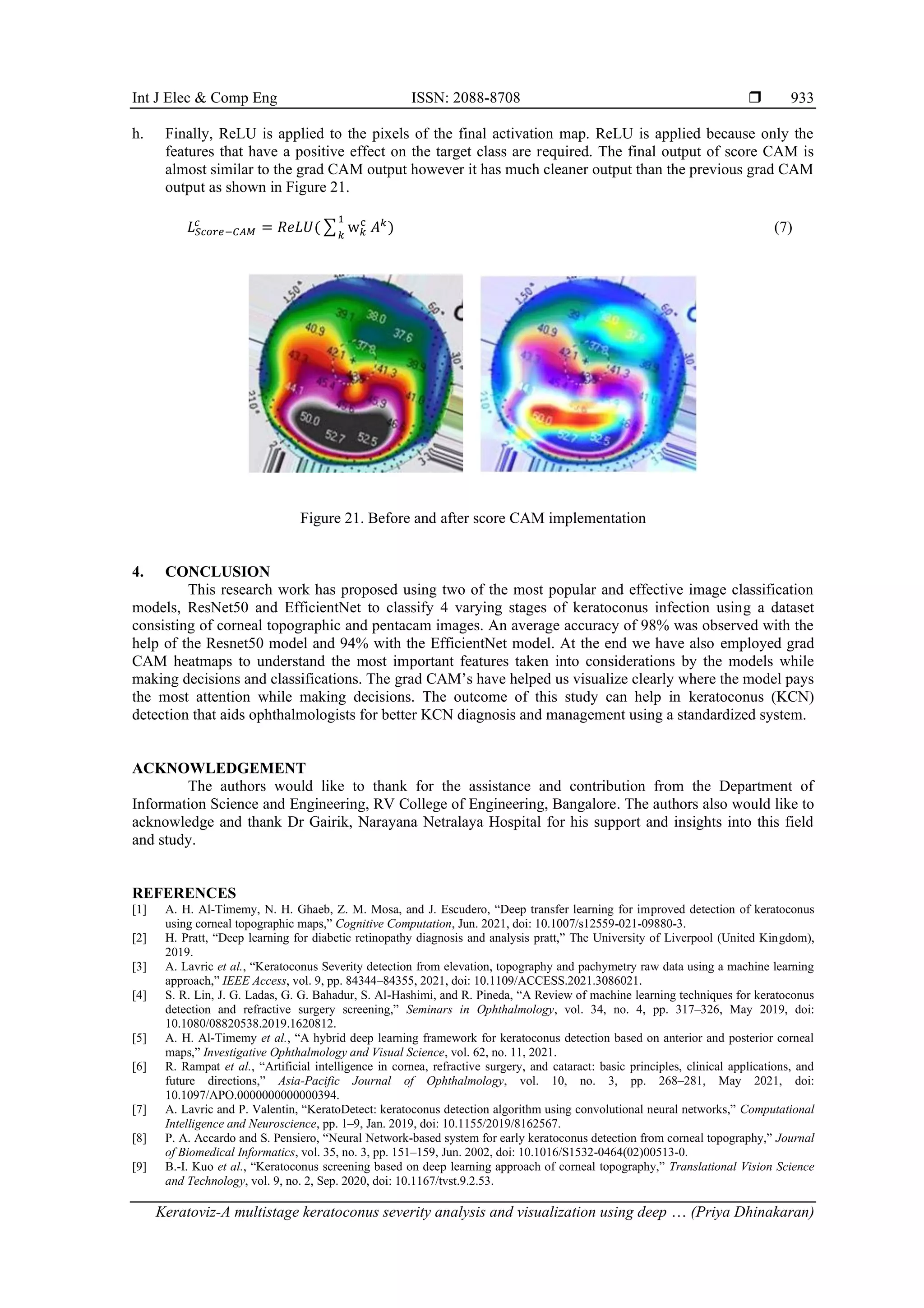 Keratoviz-A multistage keratoconus severity analysis and visualization using deep learning and ...