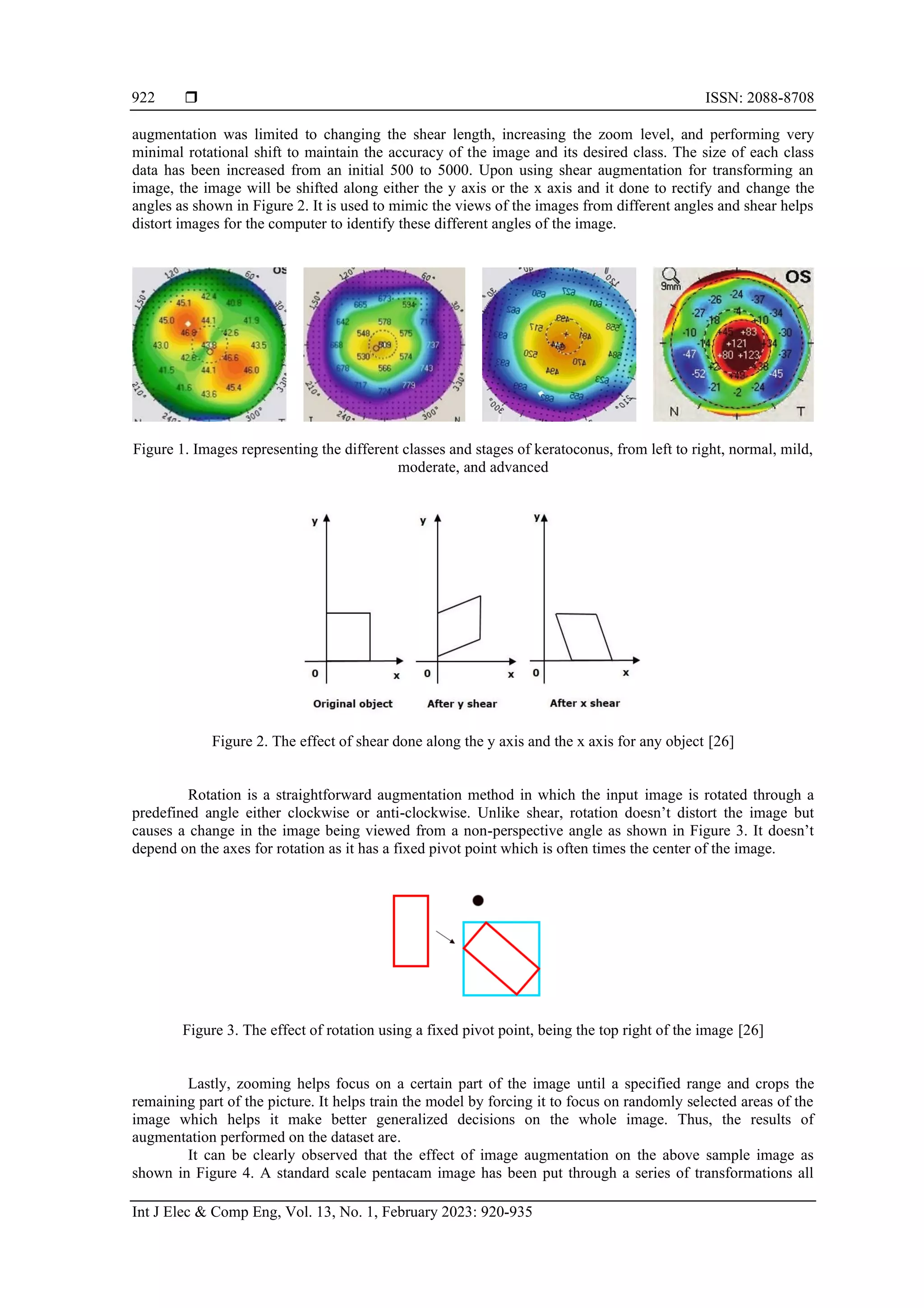 Keratoviz-A multistage keratoconus severity analysis and visualization using deep learning and ...