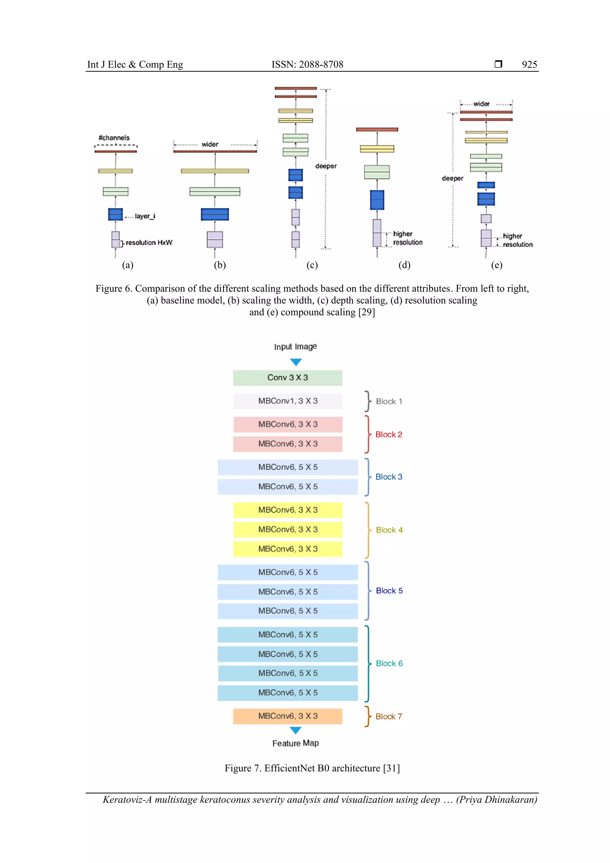 Keratoviz-A multistage keratoconus severity analysis and visualization using deep learning and ...