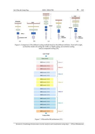 Keratoviz-A multistage keratoconus severity analysis and visualization using deep learning and ...