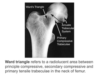 Intracapsular femoral neck fractures anatomy and biomechanics | PPTX