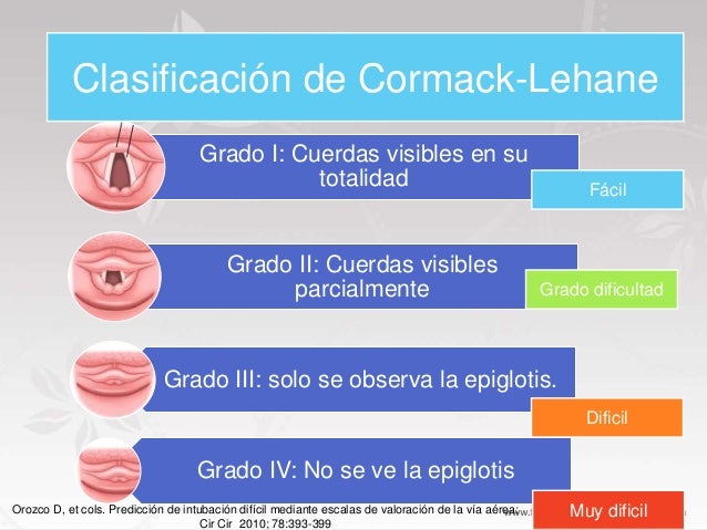 DISPOSITIVOS Y EVALUACIÓN DE LA VÍA AÉREA.