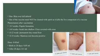 Vaccines and immunization including cold chain , Open vial policy.pptx
