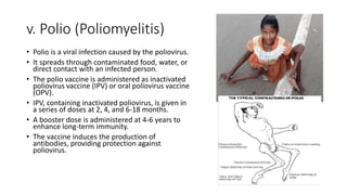 Vaccine preventable childhood diseases.pptx