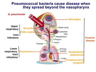 Vaccine preventable diseases | PPT