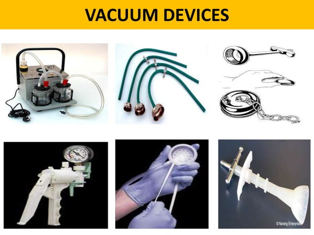 VACCUM ASSISTED DELIVERY | PPT