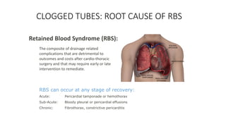 Value Analysis Committee Presentation - PleuraFlow® ACT® System | PPT