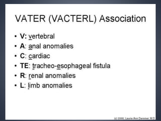 Vacterl association: embryology and recognition | PPTX