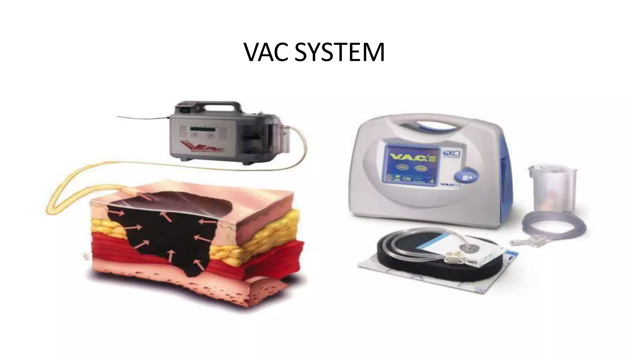 Vac therapy | PPTX