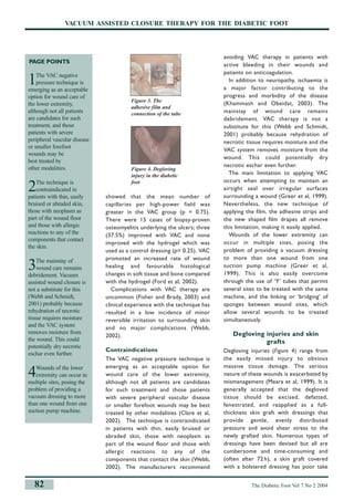 VAC therapy.pdf