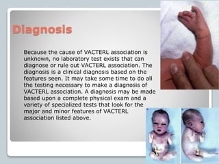 Vactrel association | PPTX