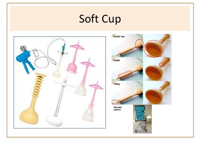 Vacuum Delivery OSCE