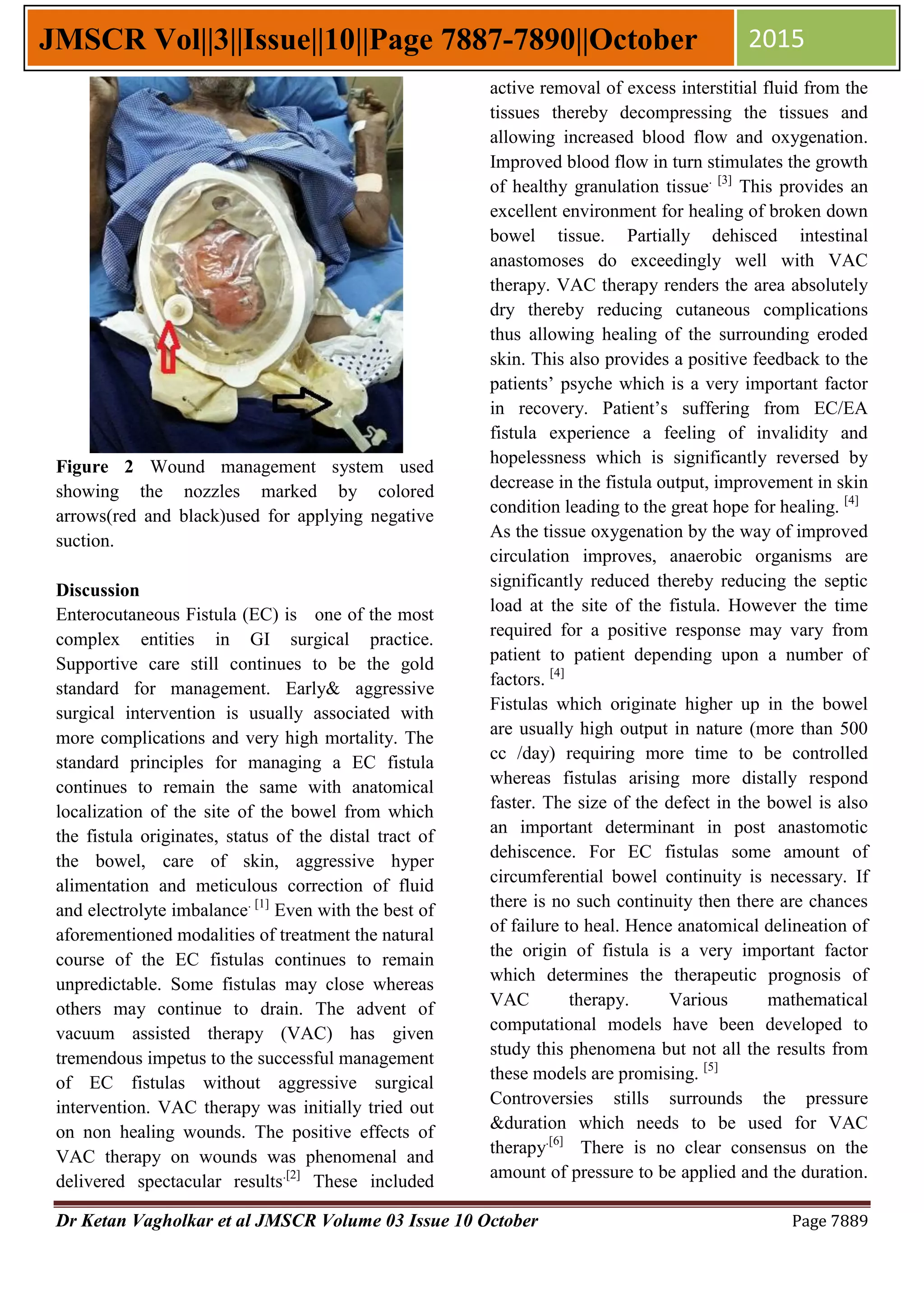 Vacuum Assisted Closure (VAC): A Promising Therapeutic Tool for ...