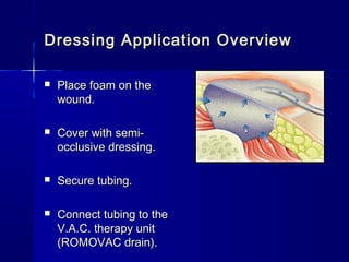Role of negative pressure wound therapy (V.A.C) in orthopaedics | PPT