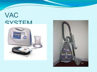 vacuum assisted closure of wound.pptx