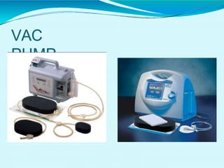 vacuum assisted closure of wound.pptx
