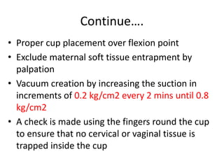 Vacuum Delivery | PPTX