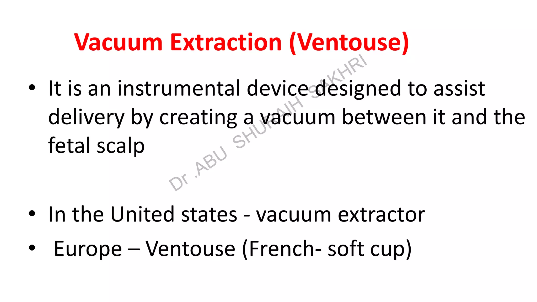 Vacuum delivery | PPTX