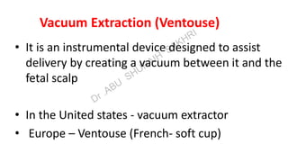 Vacuum delivery | PPTX