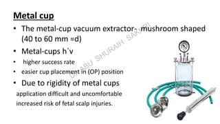 Vacuum delivery | PPTX