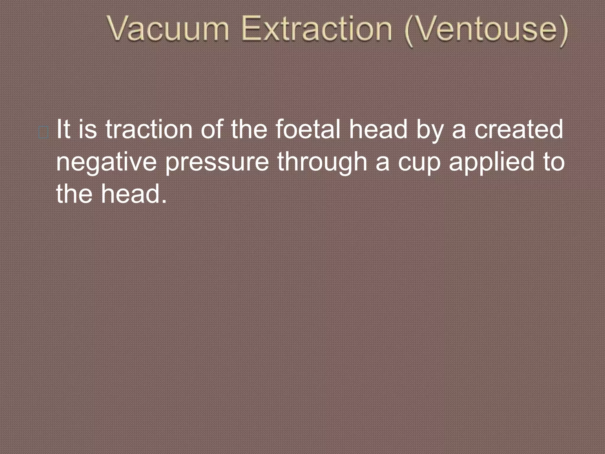 Vacuum extraction | PPTX