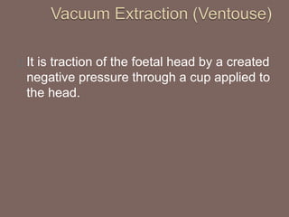 Vacuum extraction | PPTX