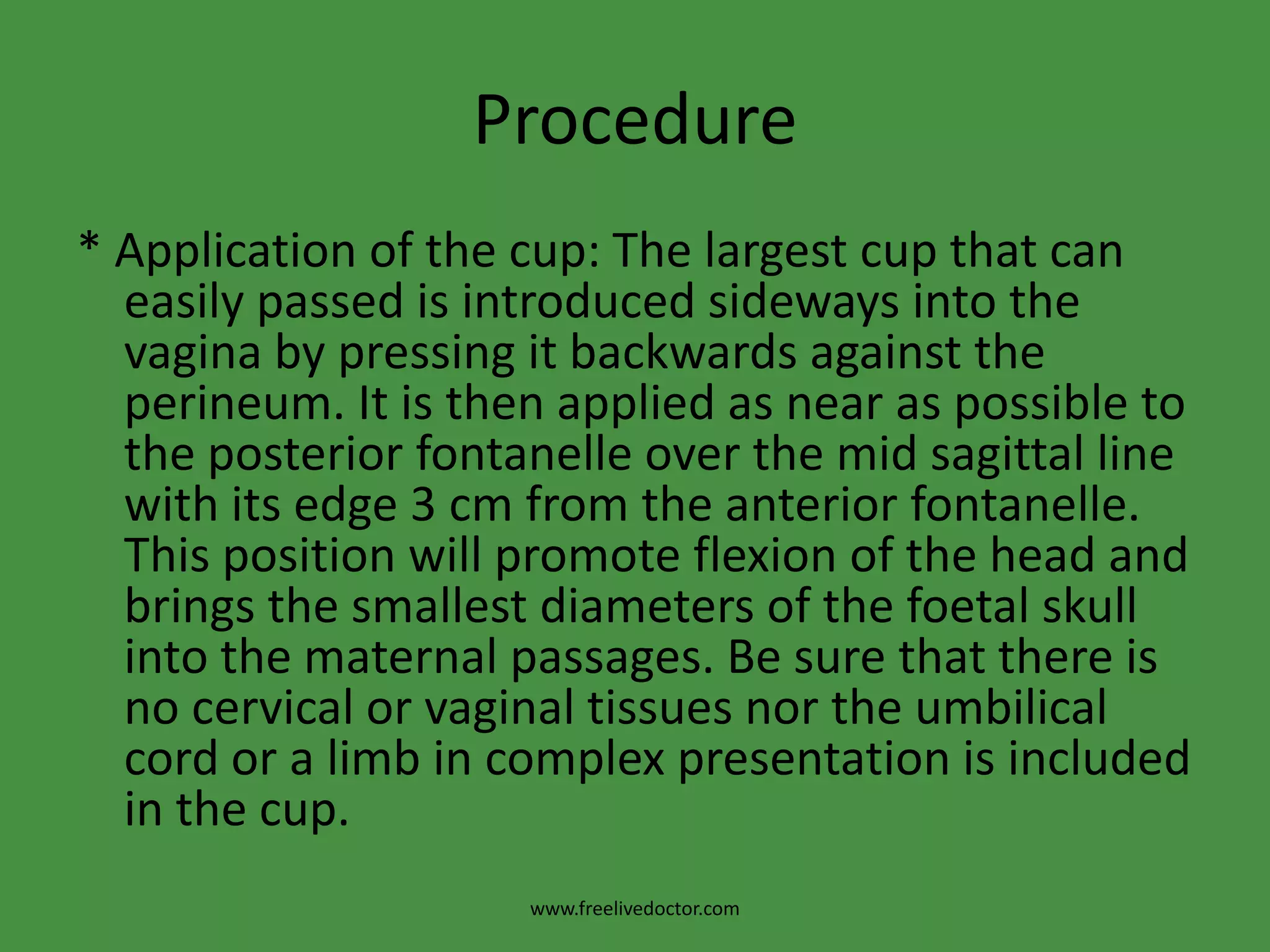 Vacuum extraction (ventouse) | PPTX