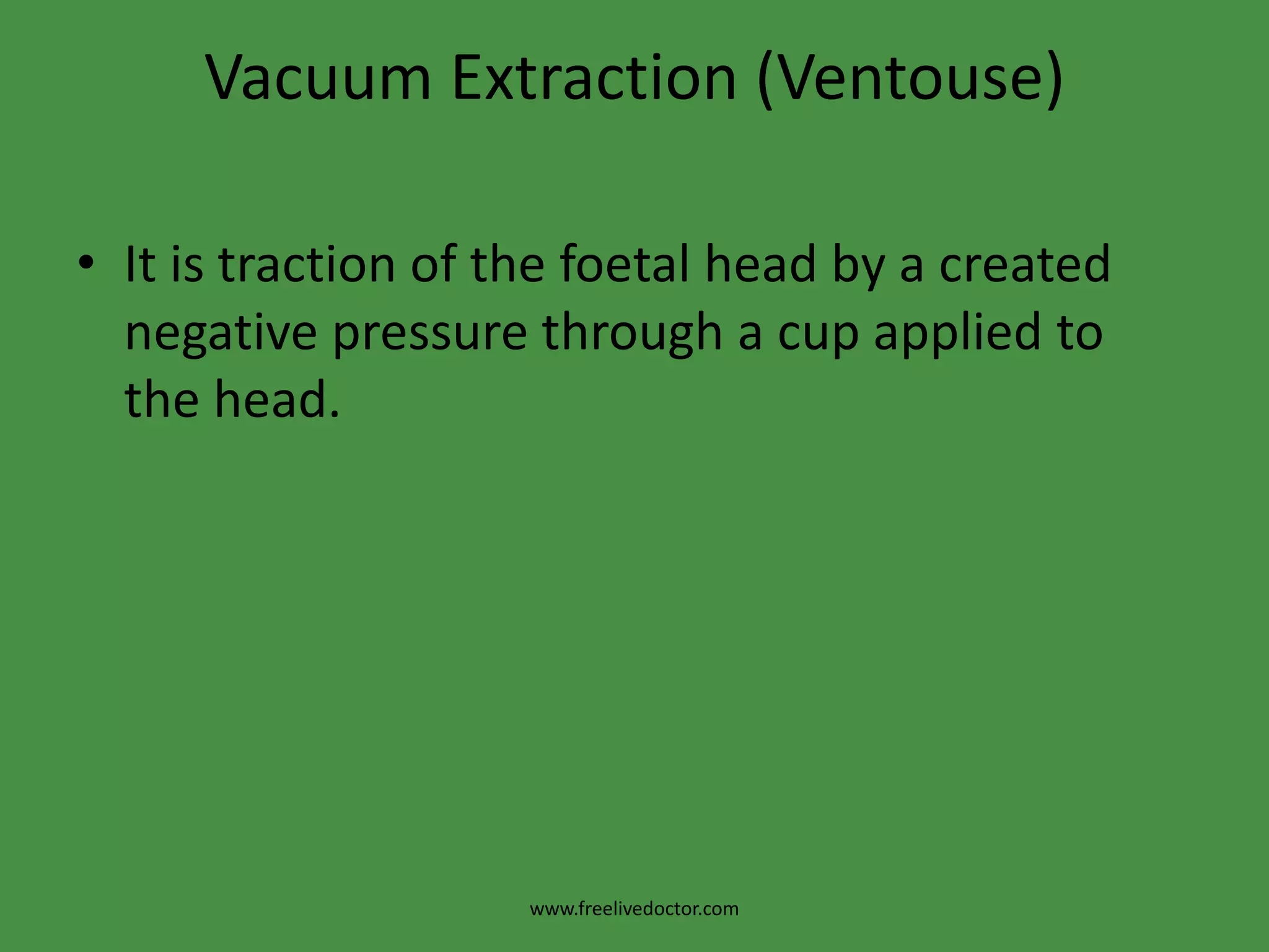 Vacuum extraction (ventouse) | PPTX