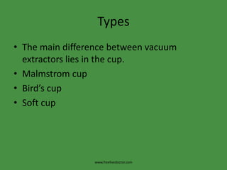 Vacuum extraction (ventouse) | PPTX