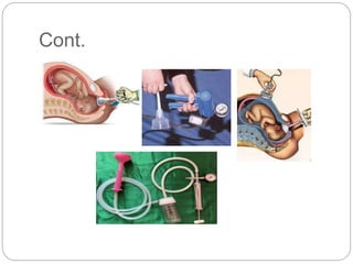 Vacuum extraction with all the details .pptx