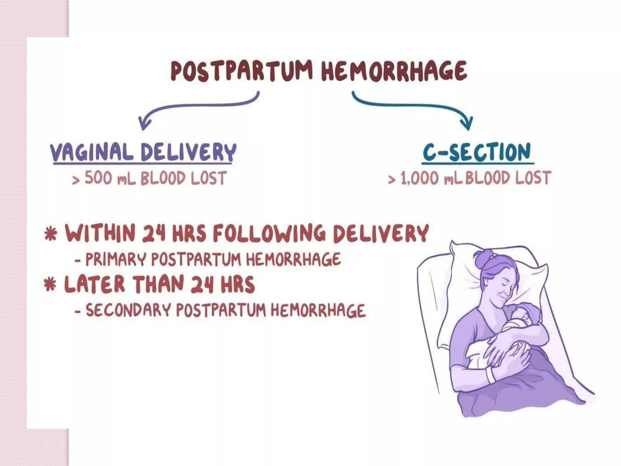 Vacuum induced uterine tamponade device for postpartum hemorrhage | PPTX