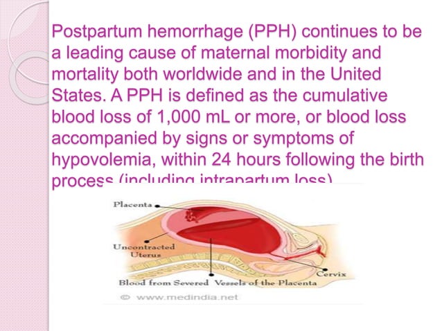 Vacuum induced uterine tamponade device for postpartum hemorrhage | PPTX