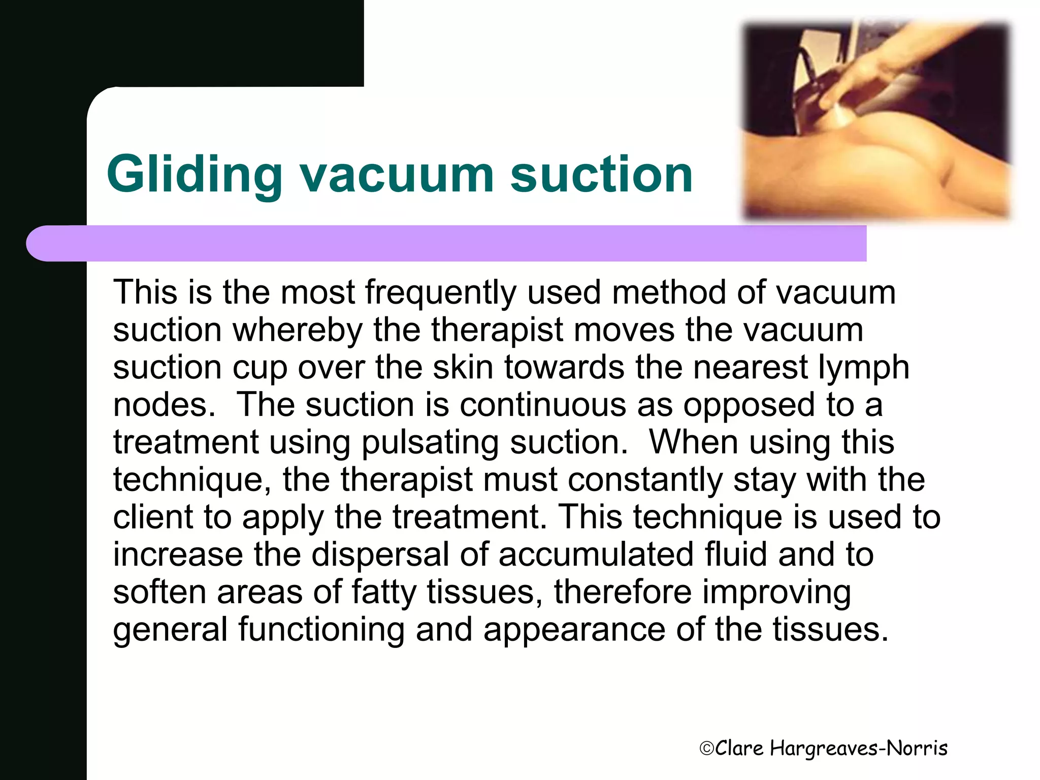 Vacuum suction powerpoint | PPTX