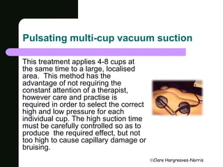 Vacuum suction powerpoint | PPTX