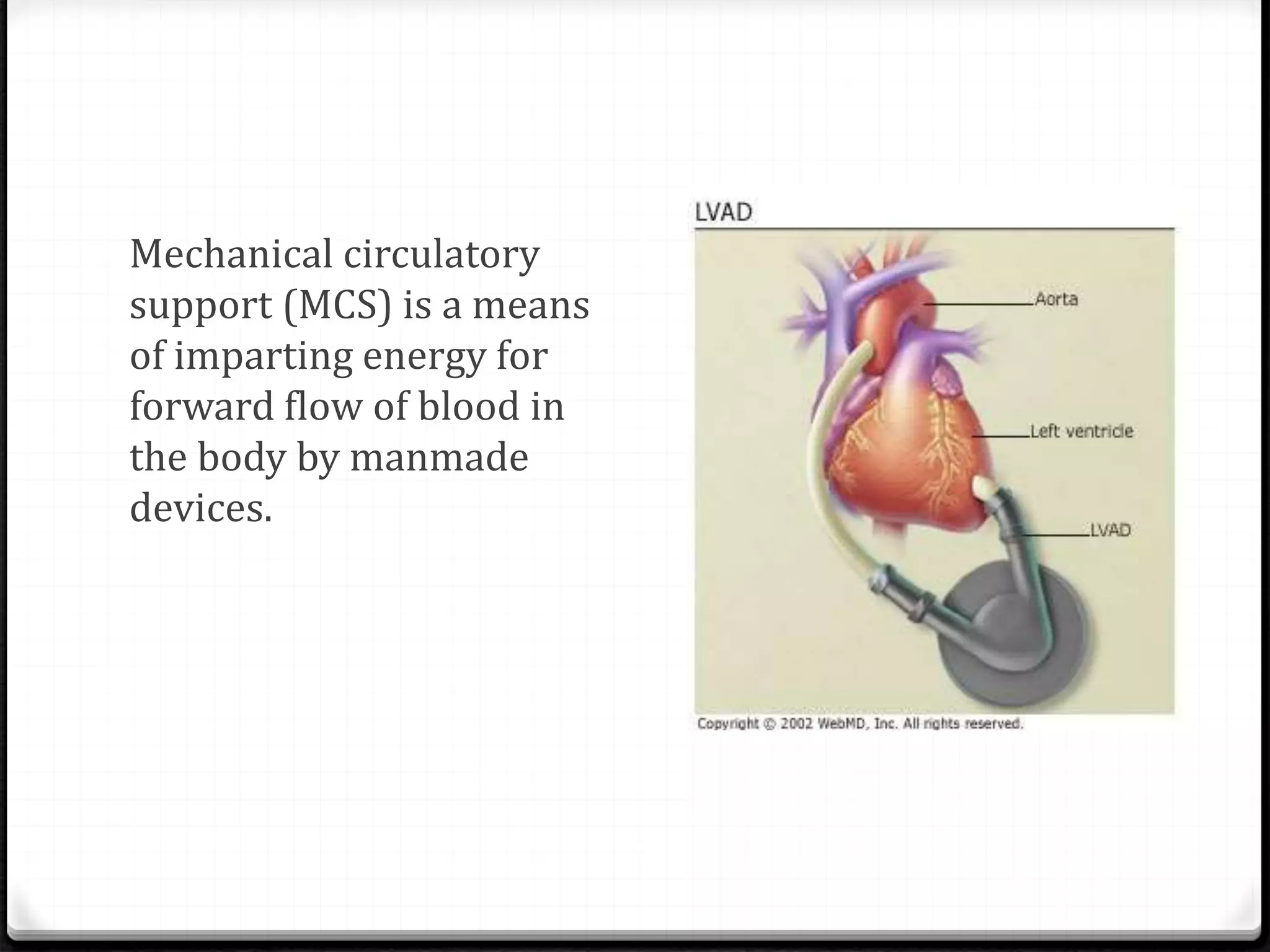 Ventricular assist devices | PPTX
