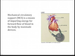 Ventricular assist devices | PPTX