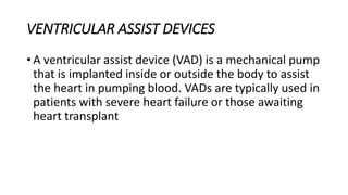 Ventriular assisted device for ventricle | PPTX