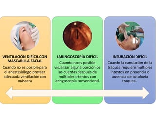 Predictores de via aerea dificil | PDF