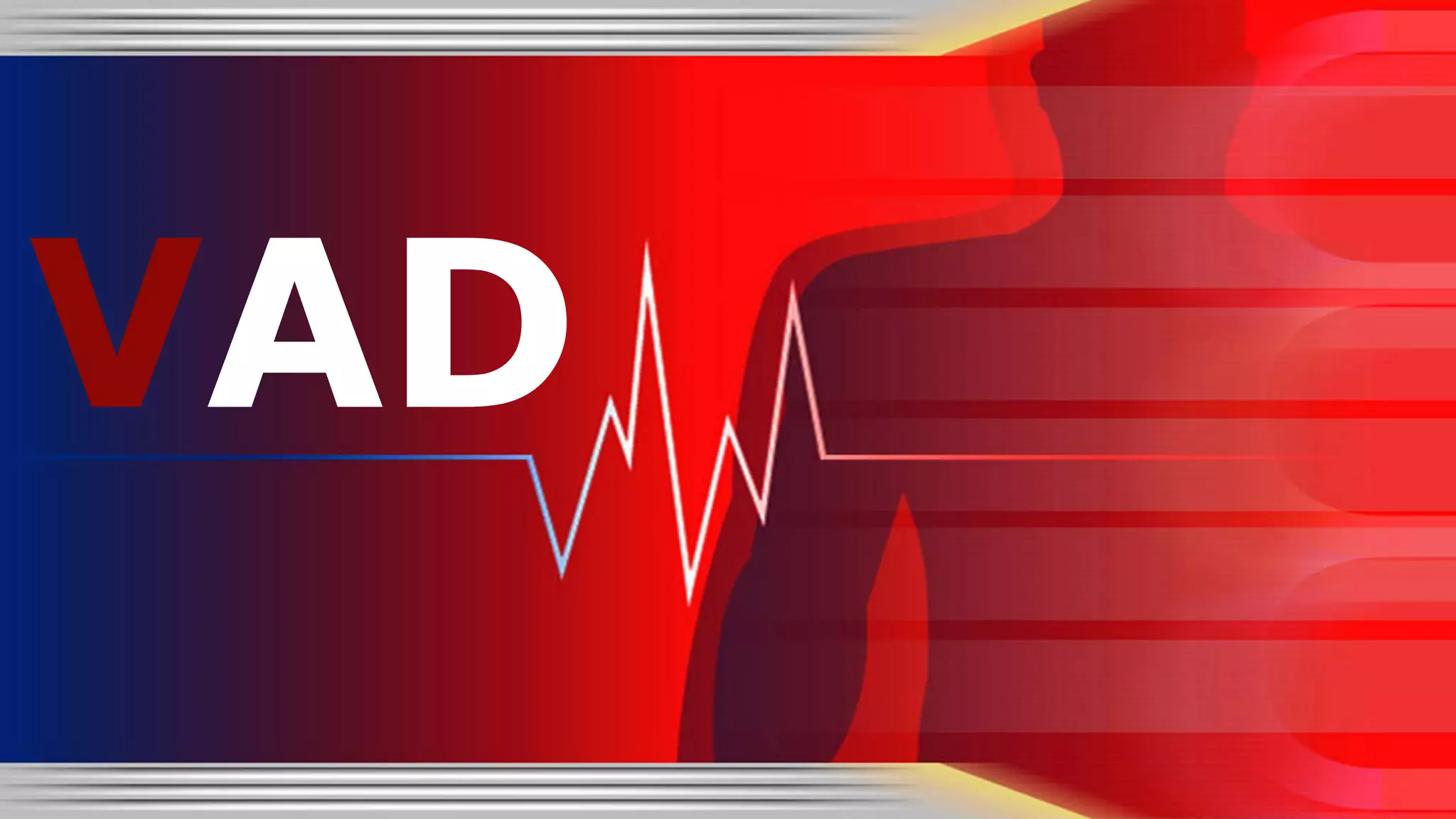 VAD Ventricular Assist Device | PPT