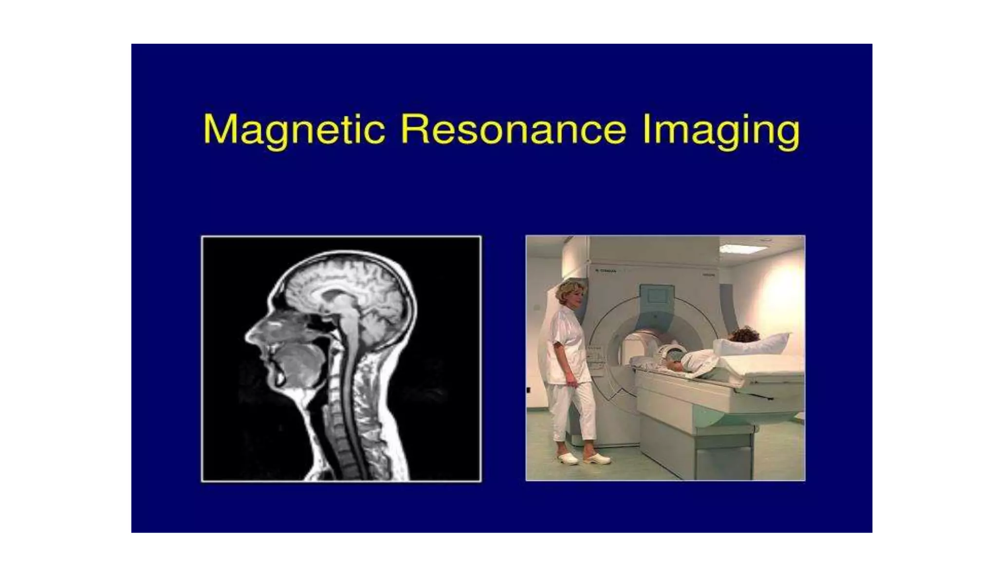 Mri And Amnesia 2 Pptx