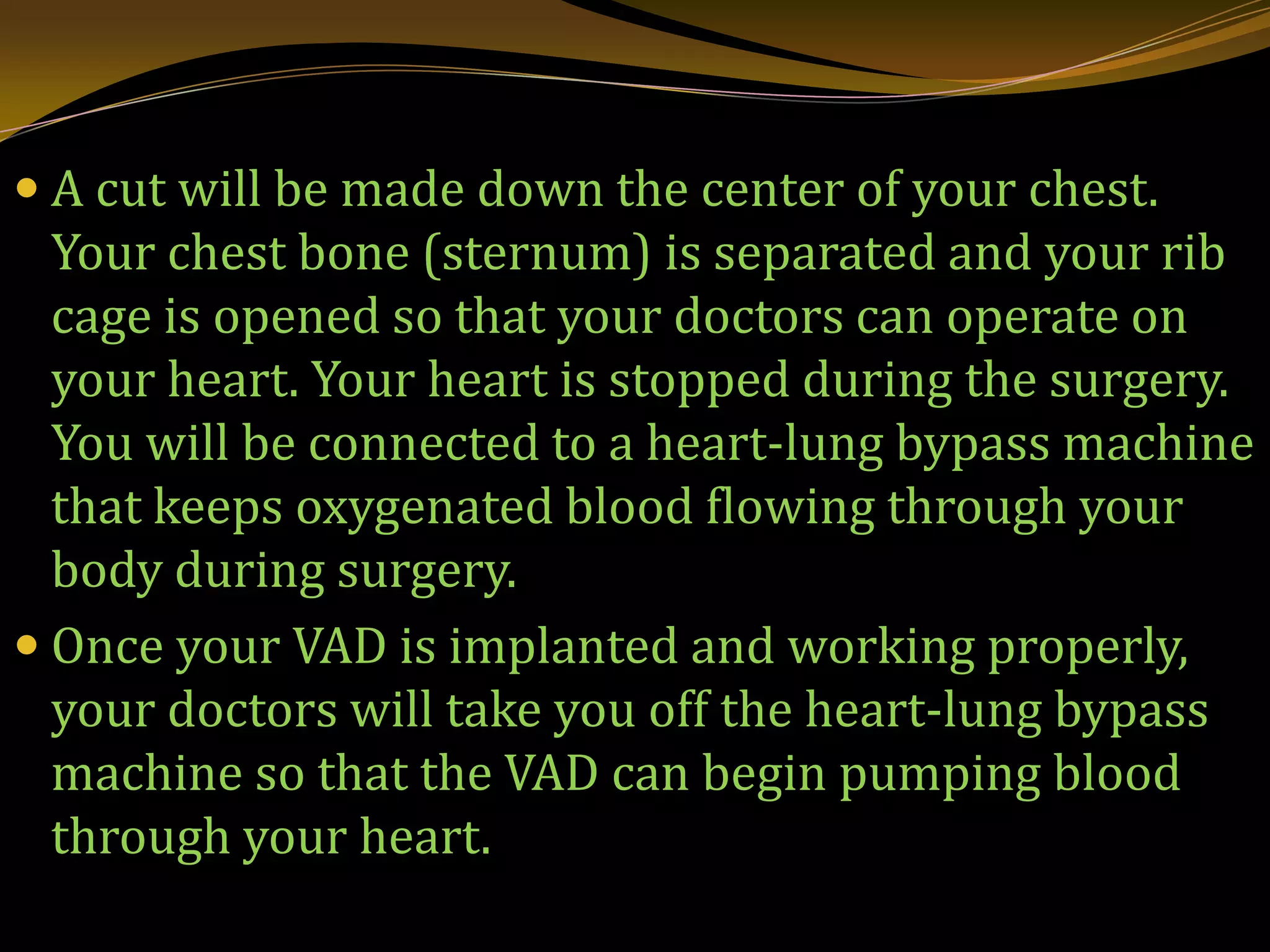 Ventricular Assist Device | PPTX
