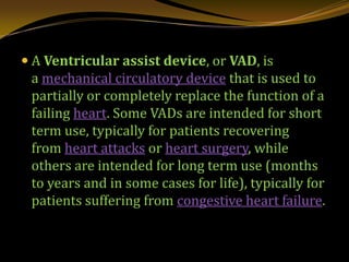 Ventricular Assist Device | PPTX