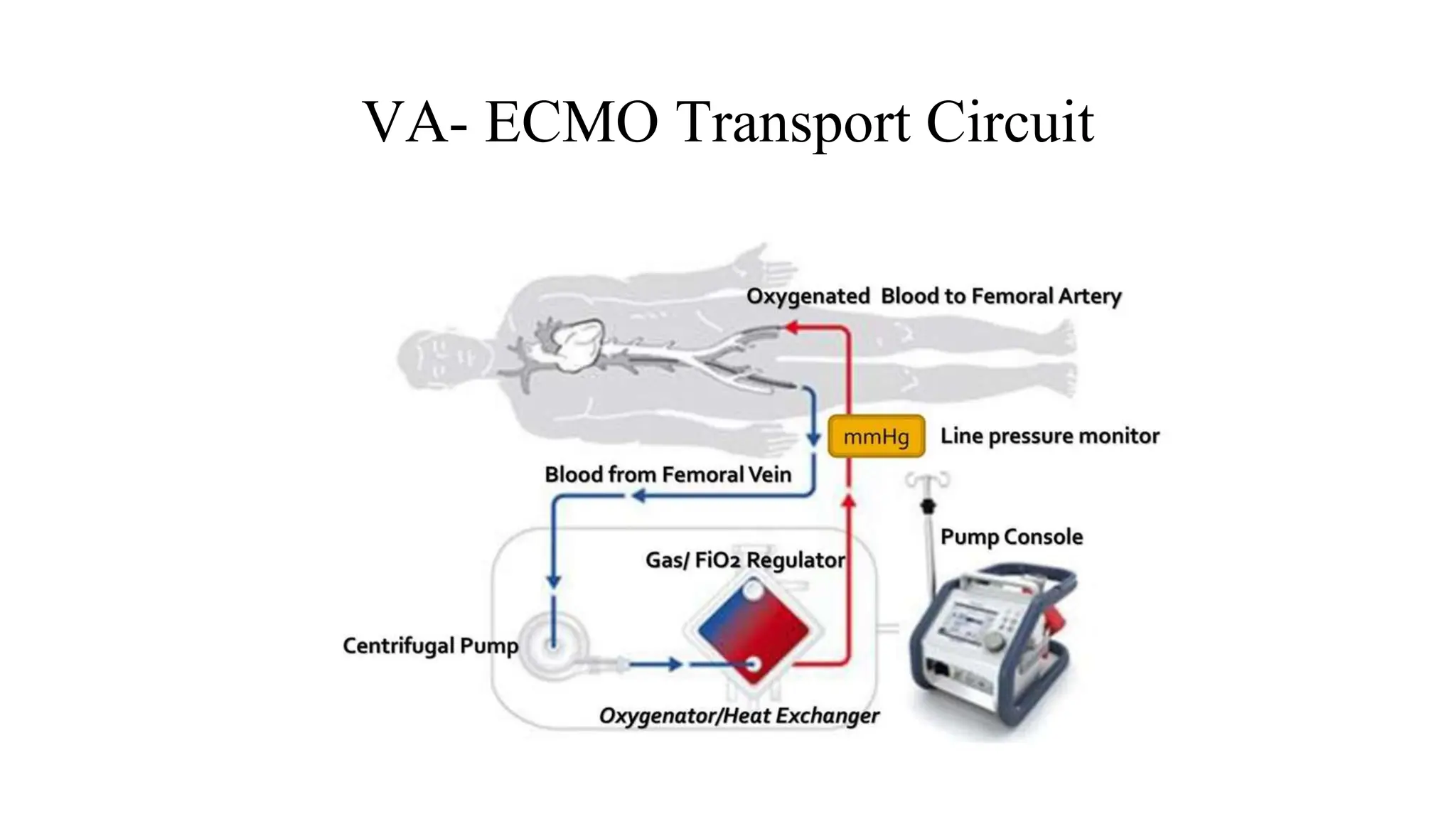 VenoArterila ECMO - 006.pptx