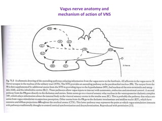 Vagal Nerve Stimulation for epilepsy | PPT