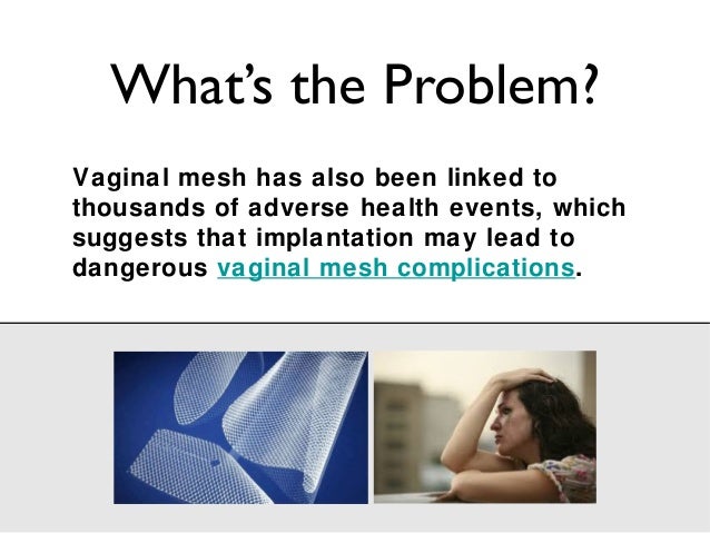 Vaginal Mesh Lawsuit Information
