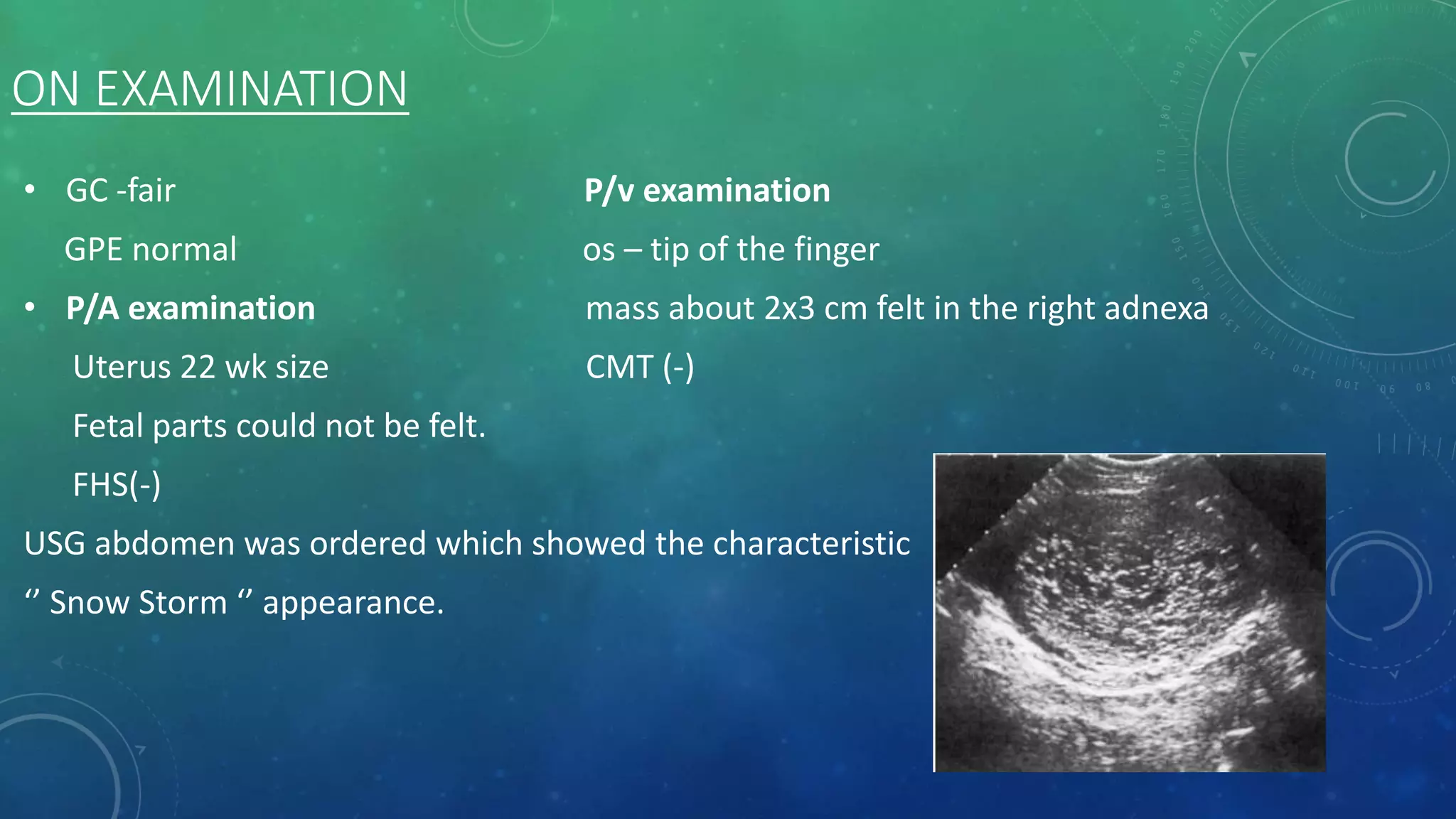 Vaginal bleeding in early pregnancy | PPTX